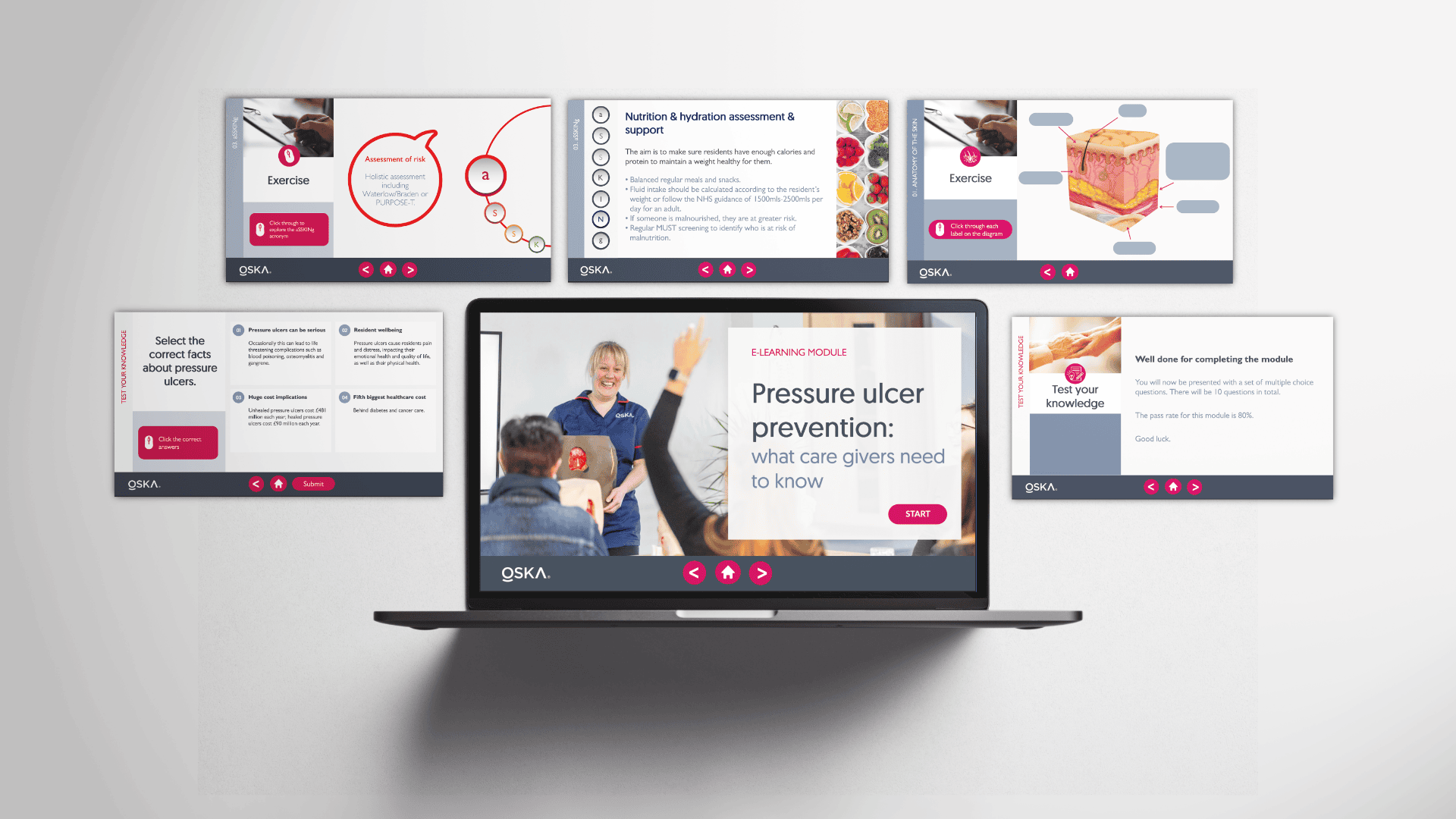 Oska Pressure Care Experts